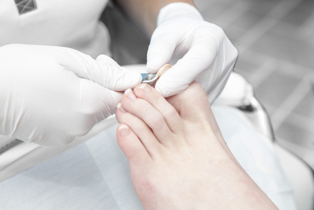 Cutting toe nails by pedicure - The Healthcare Hub