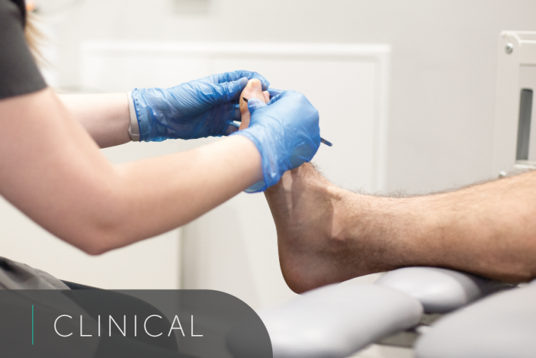 Verruca Or Corn? What Is The Difference? - The Healthcare Hub